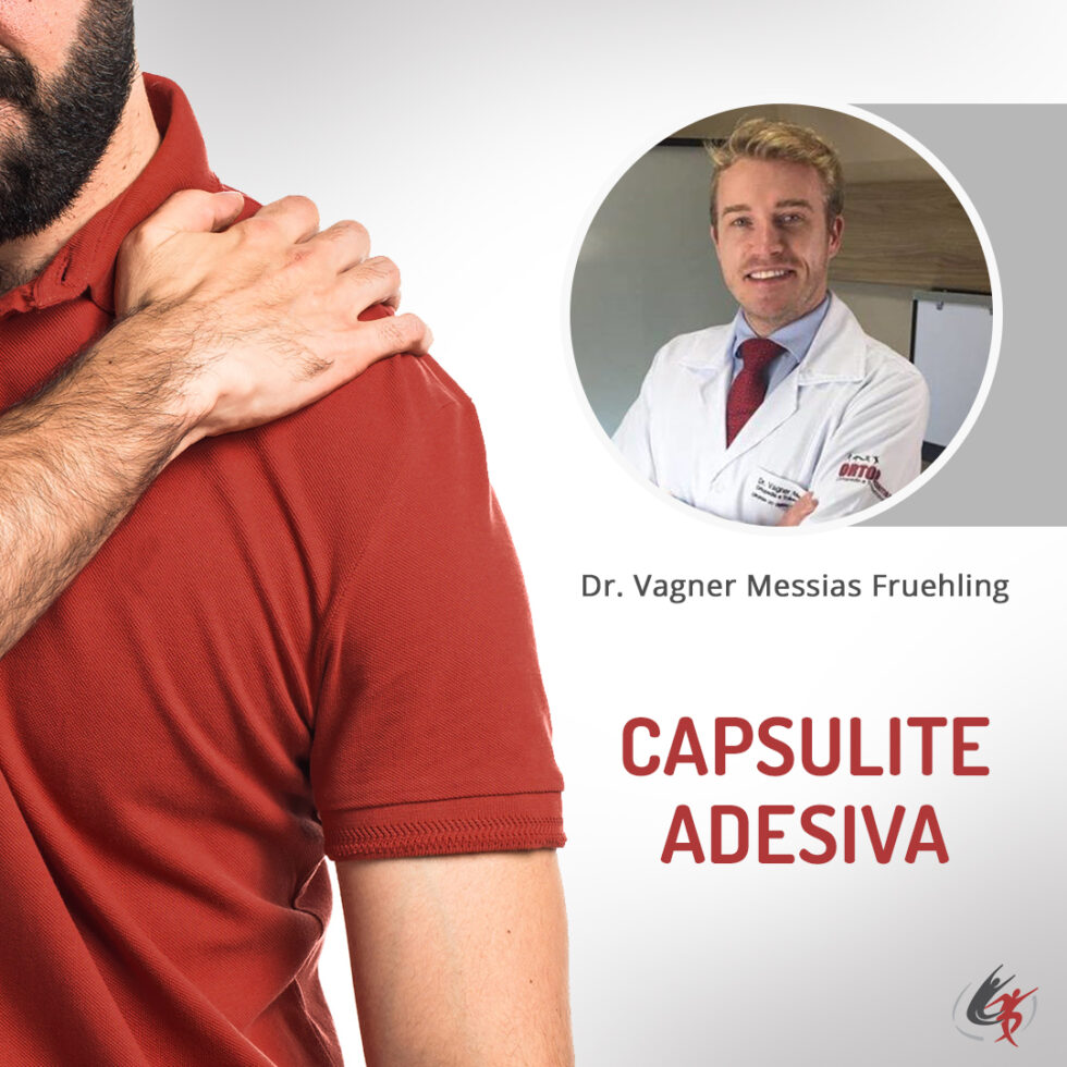 O que é Capsulite adesiva - OrtoPro Curitiba
